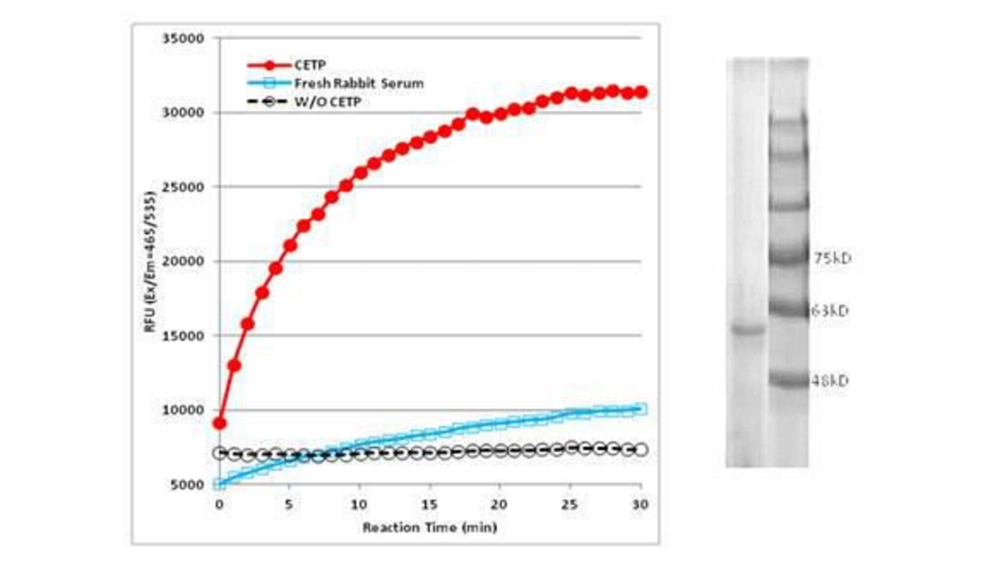 BioVision - AB285942-100UG - ACTIVE RECOMBINANT HUMAN CETP 100 UG (Each)